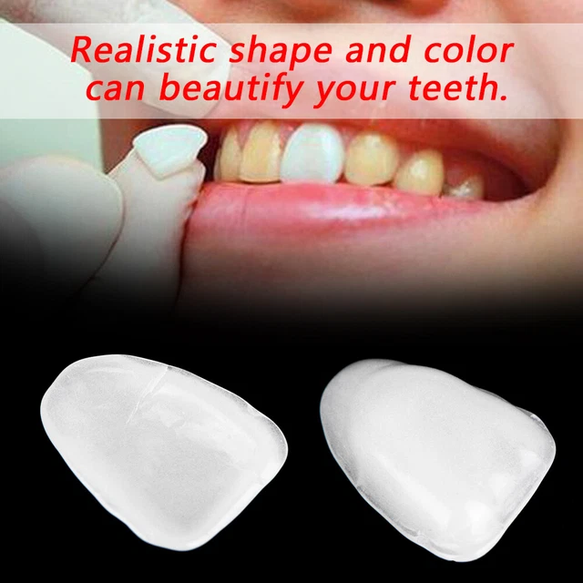 70 PCS DENTAL Oral Temporary Anterior Teeth Crown Tooth Synthetic Resin ...