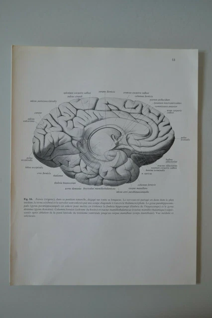 HUMAN ANATOMY BOARD NERVOUS SYSTEM BRAIN ATLAS Dr SOBOTTA MEDICINE £10. ...