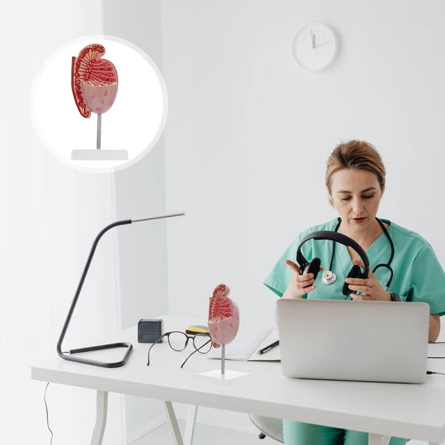 DISSECTION MODEL HUMAN Organ Enlargement Model Anatomical Model £38.28 ...