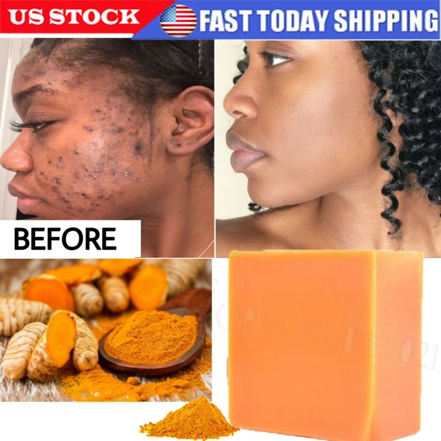 100G TUMERIC SOAP For Dark Spots, Skin Lightening, Anti Acne Skin ...