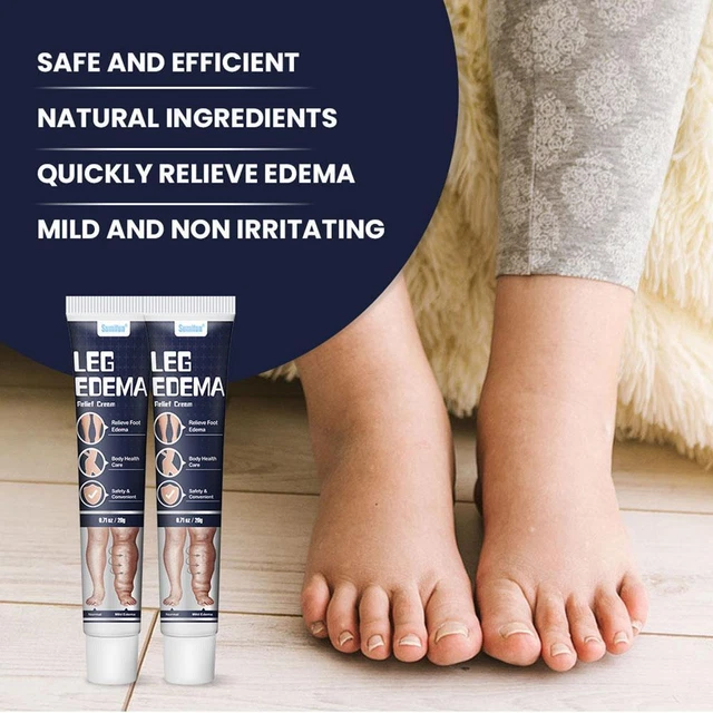LEG EDEMA RELIEF Cream Effective Foot Swelling Reduction Natural ...