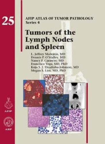 TUMORS OF THE Lymph Nodes and Spleen (AFIP Atlas of Tumor Pathology, Series 4,) £236.00 ...