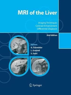 MRI OF THE Liver - 9788847057937 £71.19 - PicClick UK
