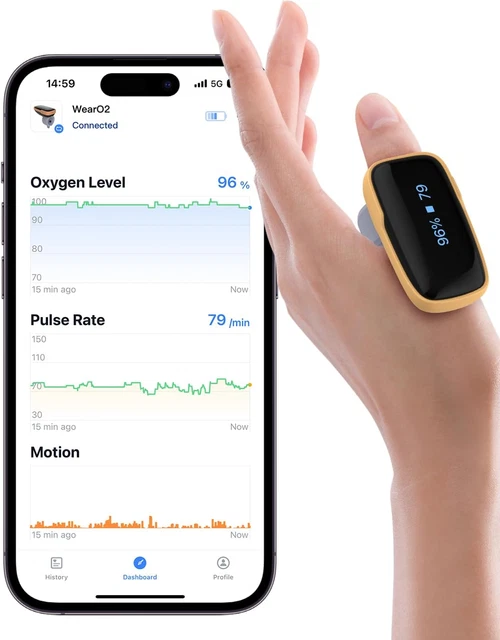 VIATOM PORTABLE O2-MONITOR, Rechargeable ...