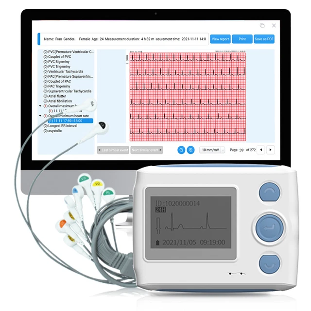 PROFESSIONAL 12 LEAD ECG Monitor 24 Hours ECG Holter Record With PC AI ...
