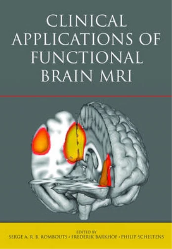 CLINICAL APPLICATIONS OF Functional Brain MRI, , Used; Good Book £9.07 ...