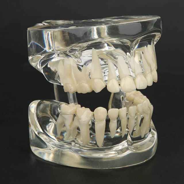 PRIMARY MODEL DECIDUOUS Teeth Model For Kindergarten Hospital ...
