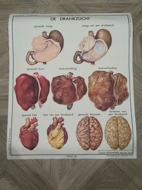 VINTAGE DUTCH HUMAN Anatomy Educational Chart Poster Organs Eyes Double ...