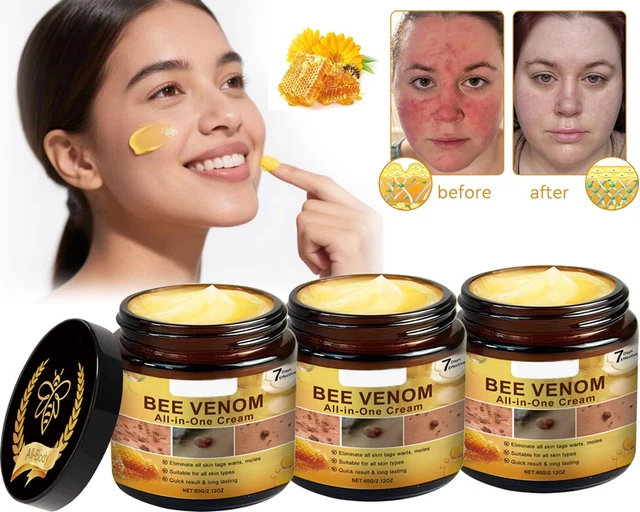BEE VENOM ALL-IN-ONE Cream Skin Treatment 2025 Professional Bee Venom ...