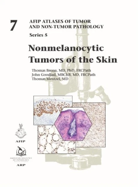 THOMAS MENTZEL - Nonmelanocytic Tumors of the Skin - New Hardback ...