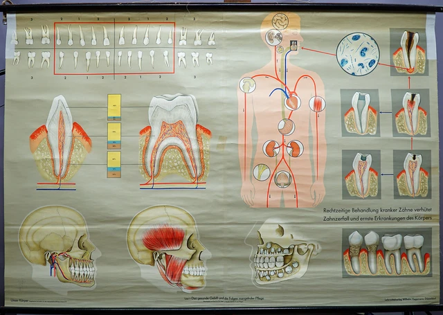 MEDICAL ROLLABLE WALLCHART vintage poster human body bit jaws teeth ...