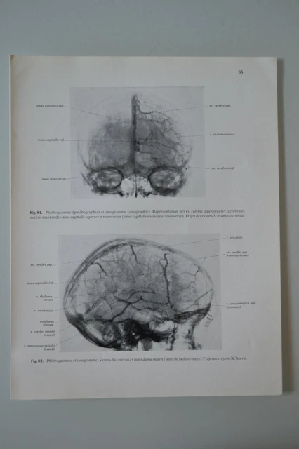 HUMAN ANATOMY BOARD NERVOUS SYSTEM BRAIN ATLAS Dr SOBOTTA MEDICINE £10. ...