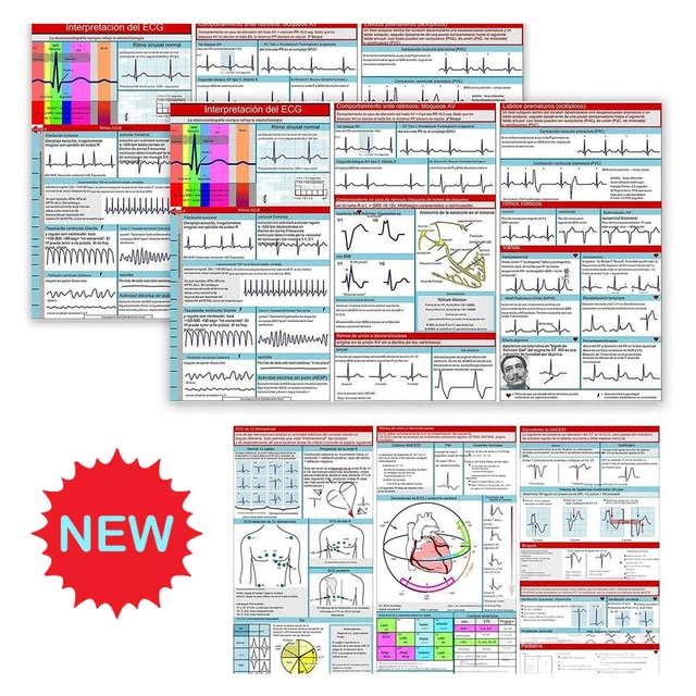 EKG POCKETGUIDE CHEAT SheetDouble Sided Tri-fold ECG Interpretation $8. ...