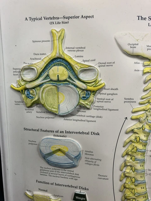 VINTAGE ANATOMICAL “THE Human Spine Disorders” Chart 3D ~ Rare £29.99 ...