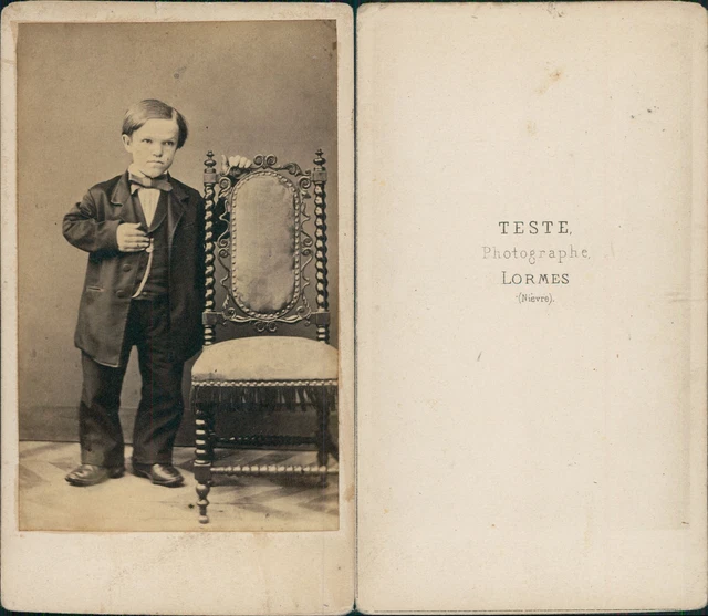 TESTE, LORMES, NAIN, nains, dwarf, freak vintage CDV albumen carte de ...