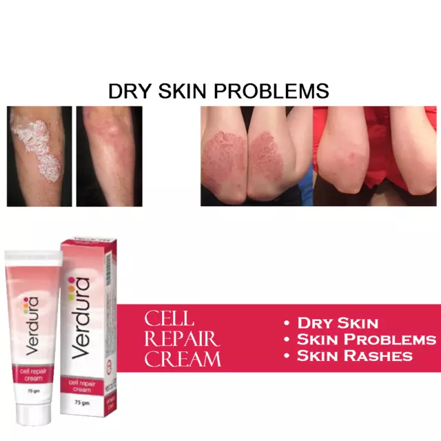 Cell Repair Cream Skin Rash Itchy And Dry Skin Relief Skin Moisturiser Ointment Eur 2085