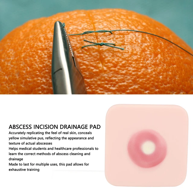 ABSCESS INCISION DRAINAGE Pad Sebaceous Cyst Surgical Removal Abscess ...