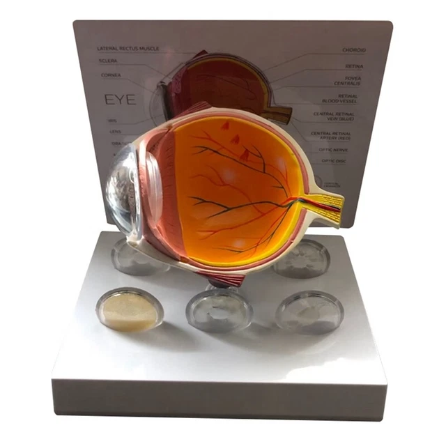 EYEBALL MODEL HUMAN Eye Demonstration Glaucoma Cataract Anatomy ...