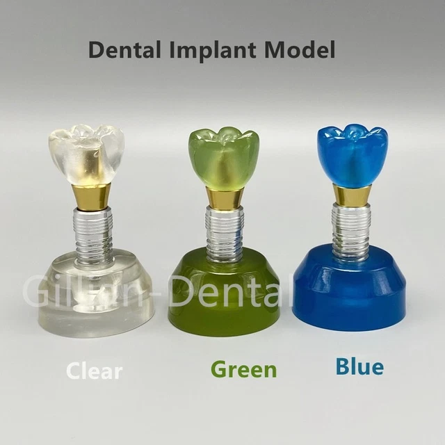 DENTAL DETACHABLE IMPLANT Abutment Study Teach Model Dentistry Teeth ...