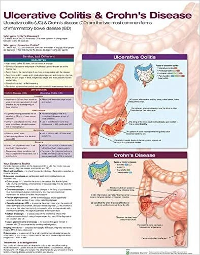 ULCERATIVE COLITIS & Crohn's Disease Anatomical Chart Laminated ...