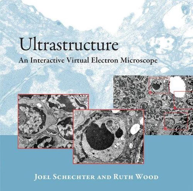 ULTRASTRUCTURE: AN INTERACTIVE Virtual Electron Microscope by Ruth I ...