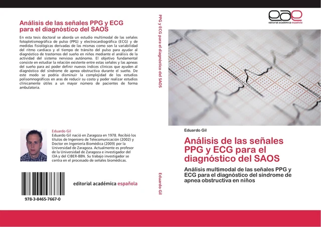 ANÁLISIS DE LAS señales PPG y ECG para el diagnóstico del SAOS Eduardo ...