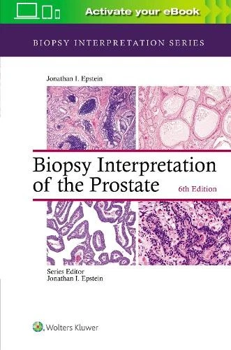JONATHAN I. EPSTEIN Biopsy Interpretation of the Prostate (Hardback) £ ...