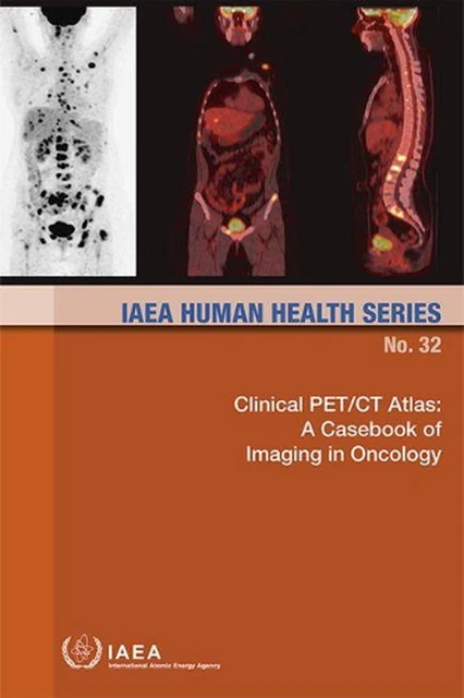 CLINICAL PET/CT ATLAS: a casebook of imaging in oncology by ...