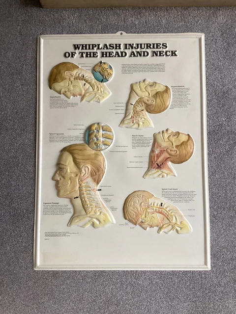 ANATOMICAL CHART COMPANY Whiplash Injuries 3D Wall Chart Medical ...