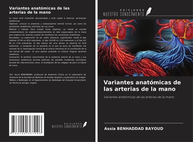 VARIANTES ANATÓMICAS DE las arterias de la mano | Assia Benhaddad ...