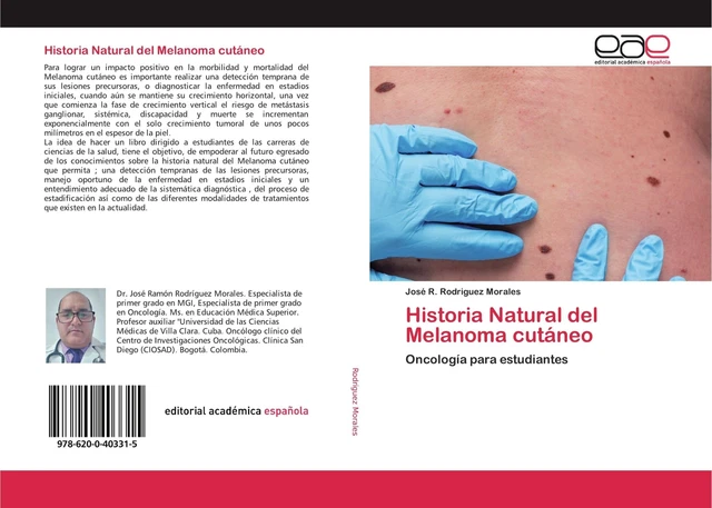 HISTORIA NATURAL DEL Melanoma cutáneo | José R. Rodriguez Morales | Taschenbuch EUR 61,95 ...