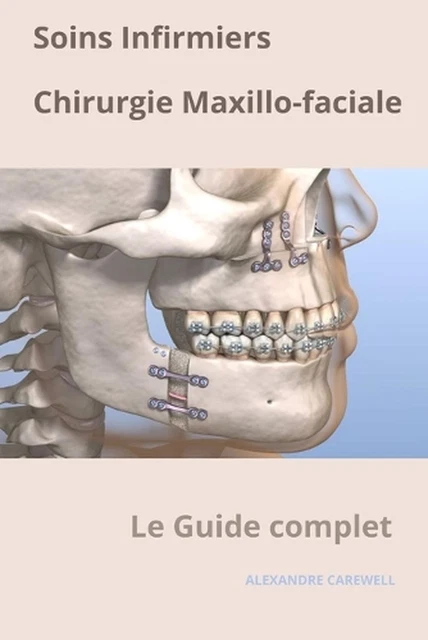 SOINS INFIRMIERS EN Chirurgie Maxillo-faciale- Le Guide Complet by ...