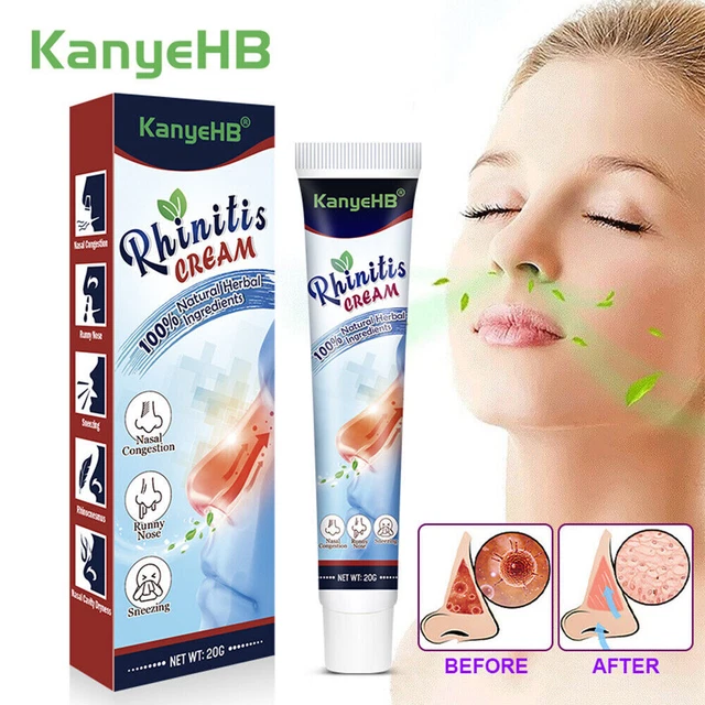 NASAL OINTMENT RHINITIS Sinusitis Cream Plaster-Relief Nasal Nose Care ...