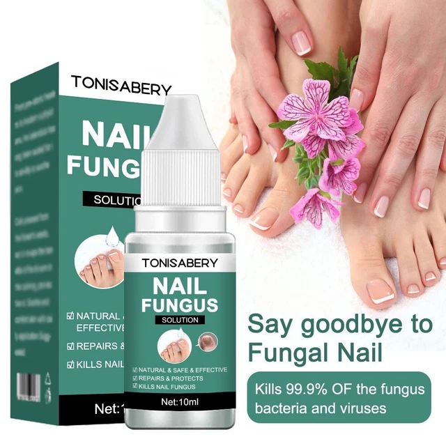 LIQUID NAIL FUNGAL Treatment Paronychia Removal Anti Infection ...