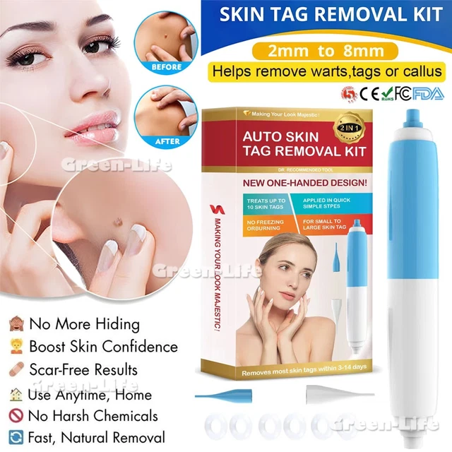 PAINLESS SKIN TAG Mole Wart Removal Kit, Auto SKIN TAG Bands Remover ...