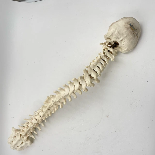 ADAM ROUILLY SPINE Model with Skull Base Medical Anatomical Teaching ...