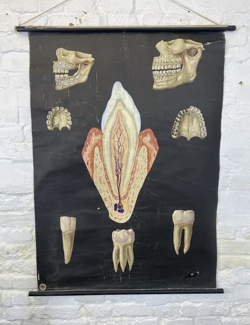 VINTAGE MEDICAL CHART TEETH DENTAL ANATOMY educational Antique poster ...