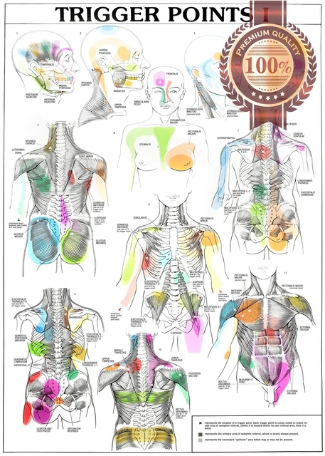 TRIGGER POINTS PART 1 Anatomical Diagram Chart Anatomy Print Premium ...