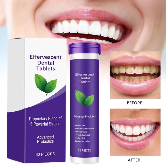 30PCS EFFERVESCENT DENTAL Tablets Probiotics Relieve Pain Prevents Bad ...