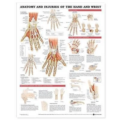 ANATOMY AND INJURIES of the Hand and Wrist Anatomical Chart by ...