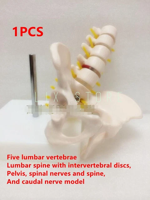 FIVE LUMBAR VERTEBRAE with pelvis and intervertebral disc nerve model ...