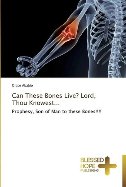 CAN THESE BONES Live? Lord, Thou Knowest...: Prophesy, Son of Man to ...