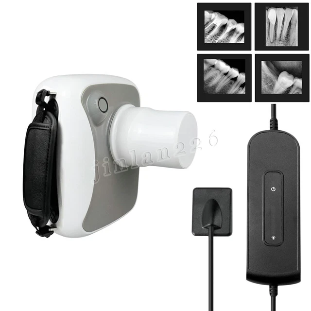 SISTEMA PORTÁTIL DE imágenes dentales sensor digital de rayos X rvg 1.5 ...