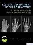 SKELETAL DEVELOPMENT OF the Hand and Wrist: A Radiographic Atlas and ...