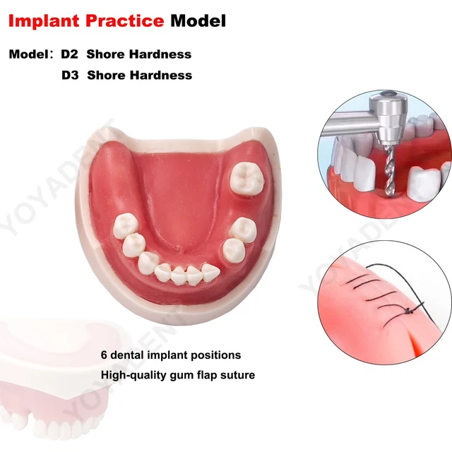DENTAL TEETH MODEL Implant Training Model For Dentistry Teach Study Gum ...