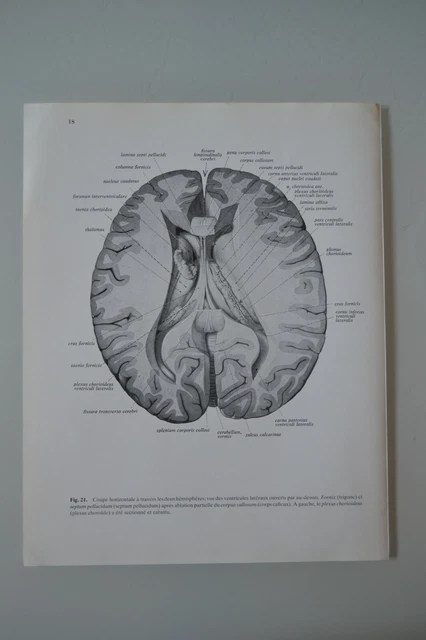 HUMAN ANATOMY BOARD NERVOUS SYSTEM BRAIN ATLAS Dr SOBOTTA MEDICINE £10. ...