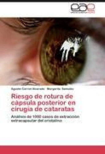 RIESGO DE ROTURA de cápsula posterior en cirugía de cataratas [Spanish ...