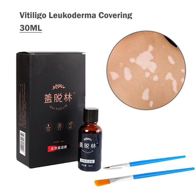 VITILIGO COVER LIQUID Scars Birthmarks Waterproof White Spots ...