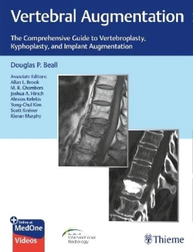 DOUGLAS P. BEALL Vertebral Augmentation (Mixed Media Product) EUR 234 ...
