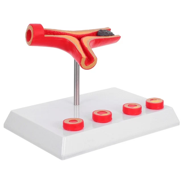 HUMAN BLOOD VESSEL Model - Cardiovascular Model For Teaching £27.39 ...